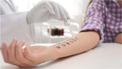 Patch Tests Phoenix | Allergy Test | San Tan Allergy